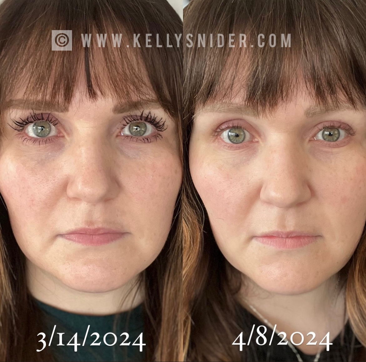 Oliveda Skincare Review: My Honest Take and Shocking Results After Only ...